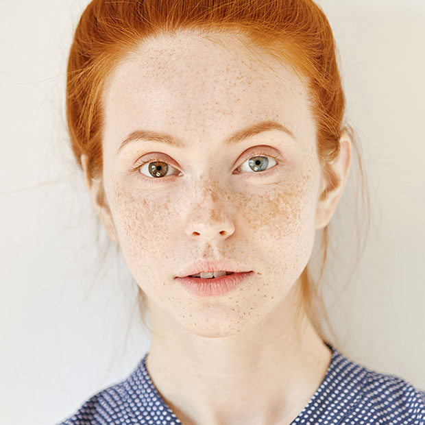 What Do You Know About Heterochromia? – Bolivar MO | Vision Source Bolivar